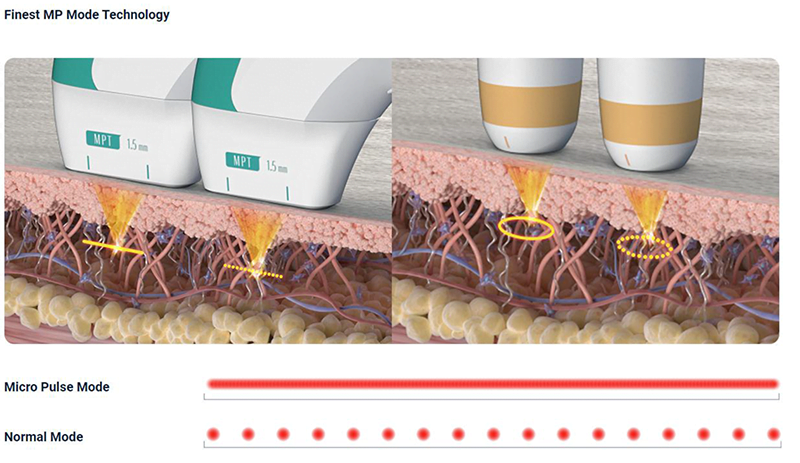 Lanree Aesthetics | Laser Medical Beauty Clinic